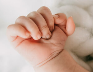 Six Fingers on One Hand | Polydactyly | IHTSC