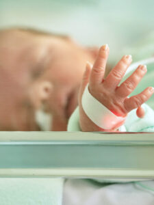 Six Fingers on One Hand | Polydactyly | IHTSC